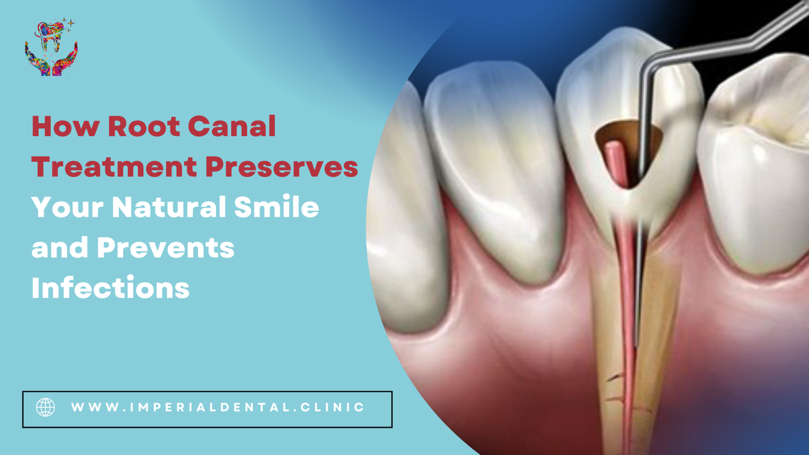 How Root Canal Treatment Preserves Your Natural Smile and Prevents ...
